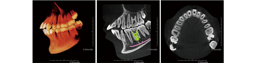 » PreXion3D エクスペディション プレキシオン株式会社 | PreXion